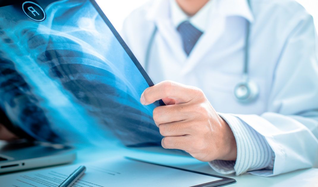 Diagnostic Imaging Specialists - Adirondack Radiology Associates, PC Diagnostic Imaging Specialists - Adirondack Radiology Associates, PC